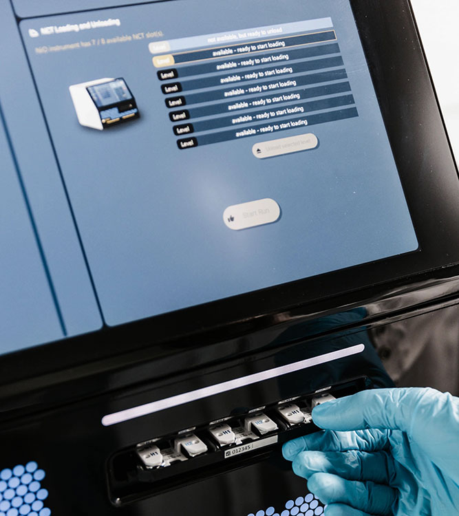 Stilla Nio Workflow – A & M